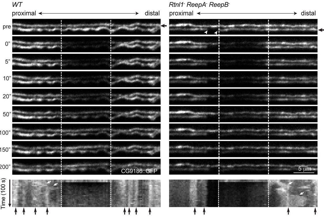 Roles of spastic paraplegia proteins in organisation of axonal ...
