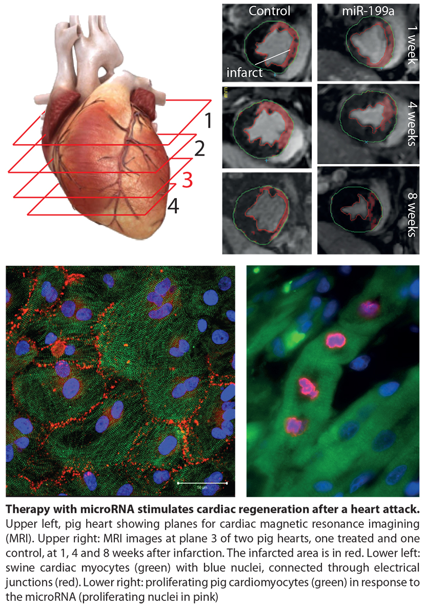 Cardiac REgeneration from within | H2020 | CORDIS | Comisión Europea